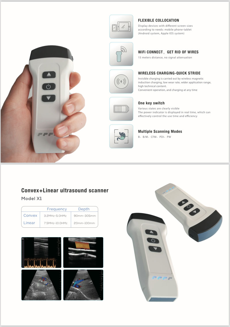 Wireless ultrasound probe with 2 handles - elecgymcenter