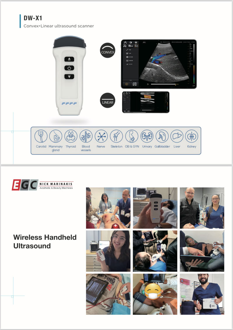 Wireless ultrasound probe with 2 handles - elecgymcenter